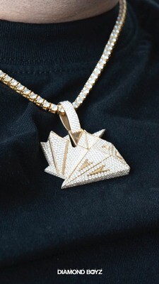 Canadian Diamond Boyz | Gold Teeth Canada