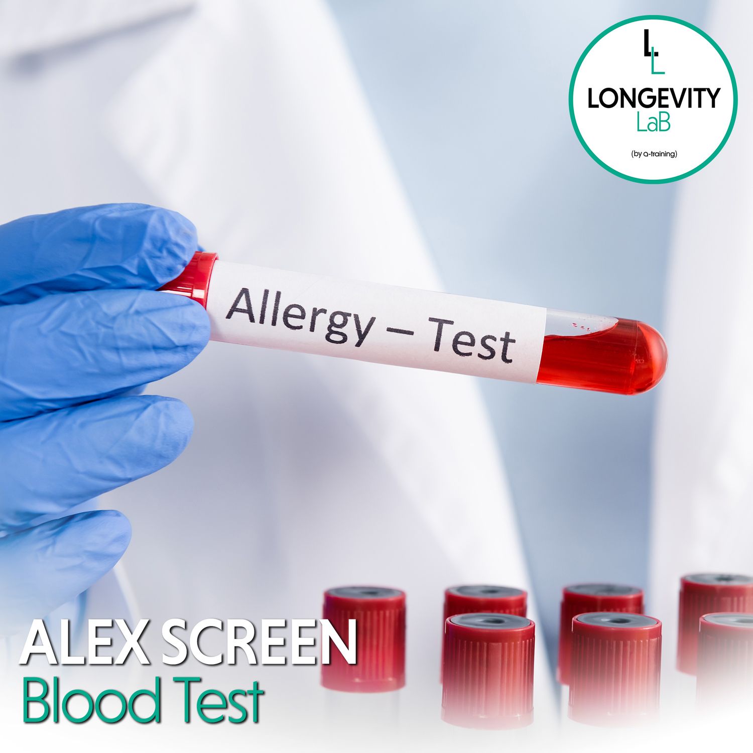 ALEX Screen – 300 Allergens Test (CLIENTS PAY £479) – Store – Longevity Lab