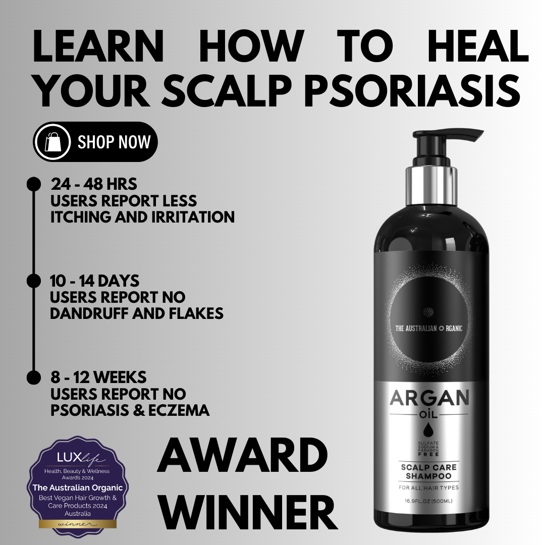 Scalp Care For Your: Psoriasis, Eczema, Itching, Sores, Scabs ...