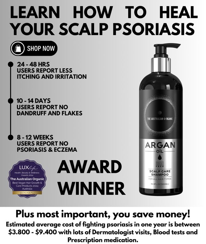 Scalp Care For Your: Psoriasis, Eczema, Itching, Sores, Scabs ...