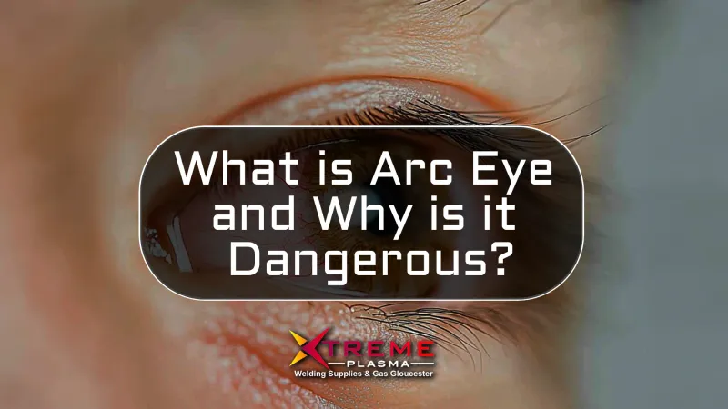 What is Arc Eye and Why is it Dangerous?