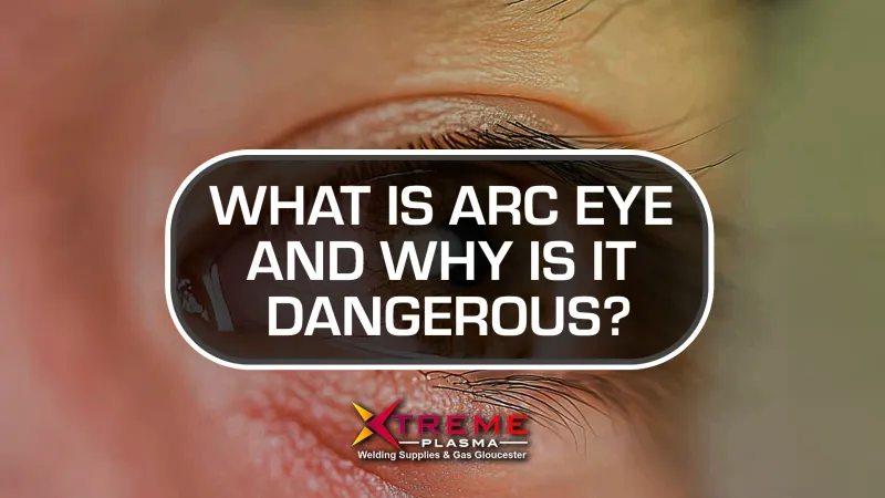 What is Arc Eye and Why is it Dangerous?