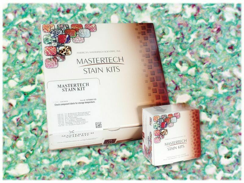 Fite's Stain Kit, Modified