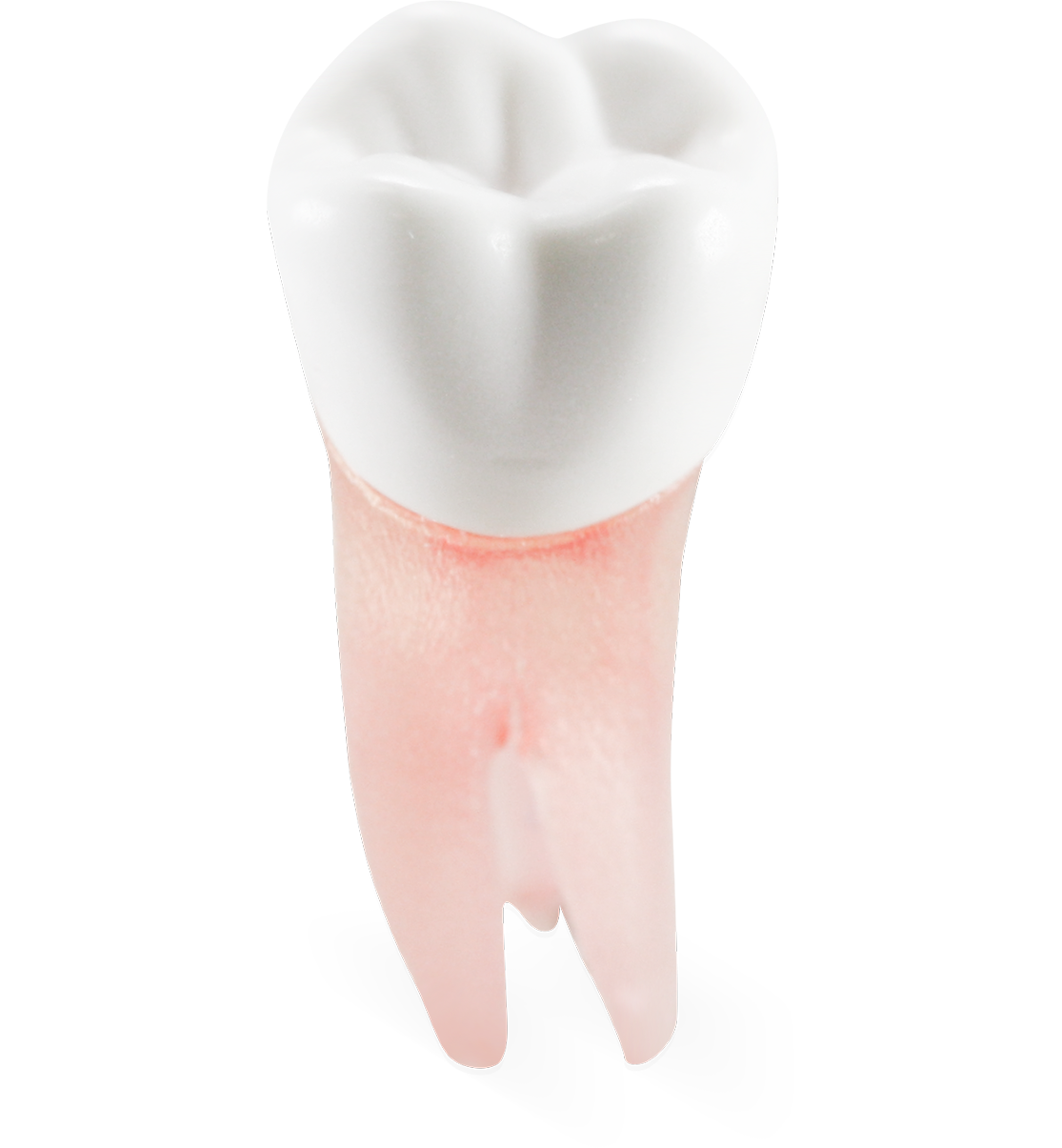 Acadental - RTE #03 Radiopaque