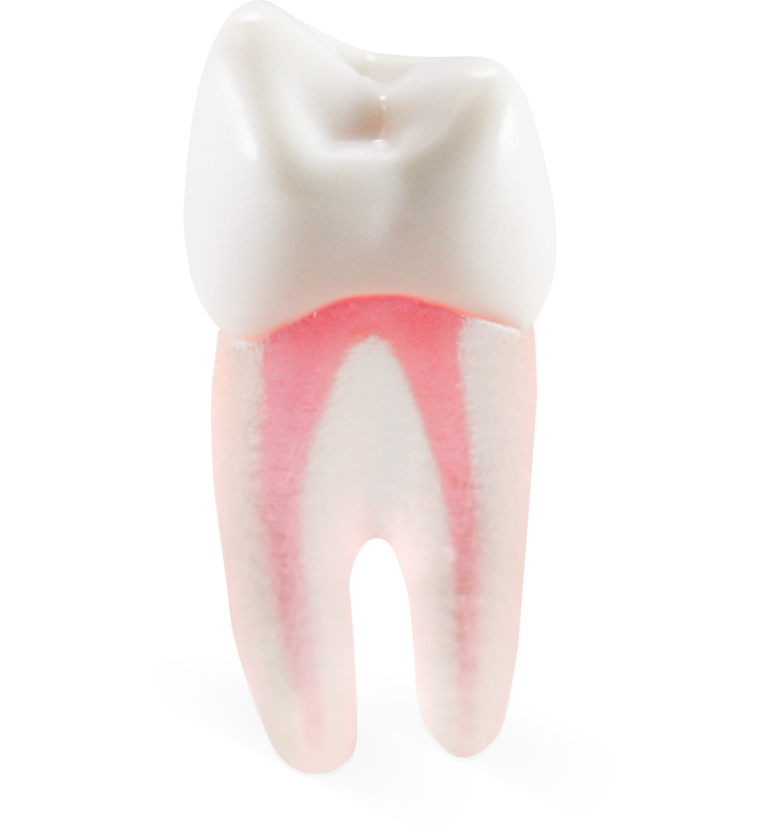 Acadental - RTE #12 Radiopaque