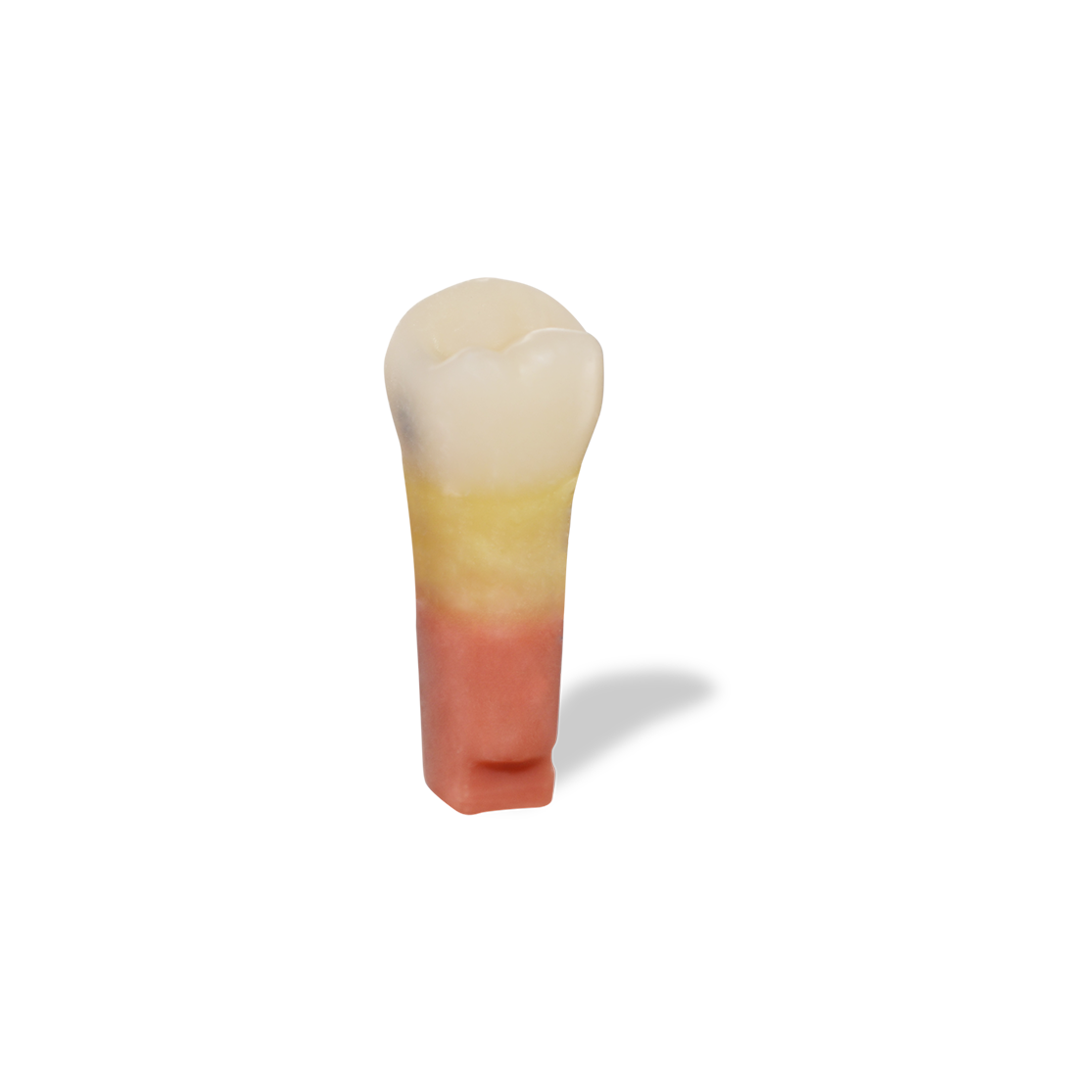 Acadental - RTX Caries Teeth Distal #20