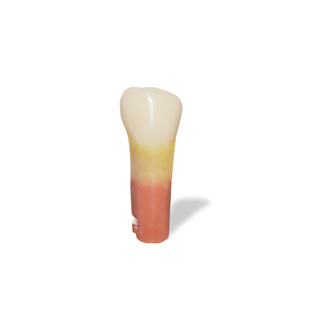 Acadental - RTX Caries Teeth Distal #20