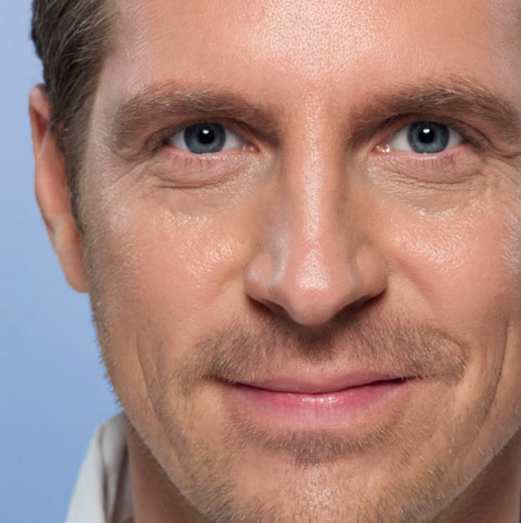 Dermatitis seborreica | ISDIN | Tienda SkinPharma | Guatemala