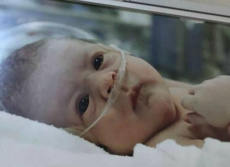 Neonatal