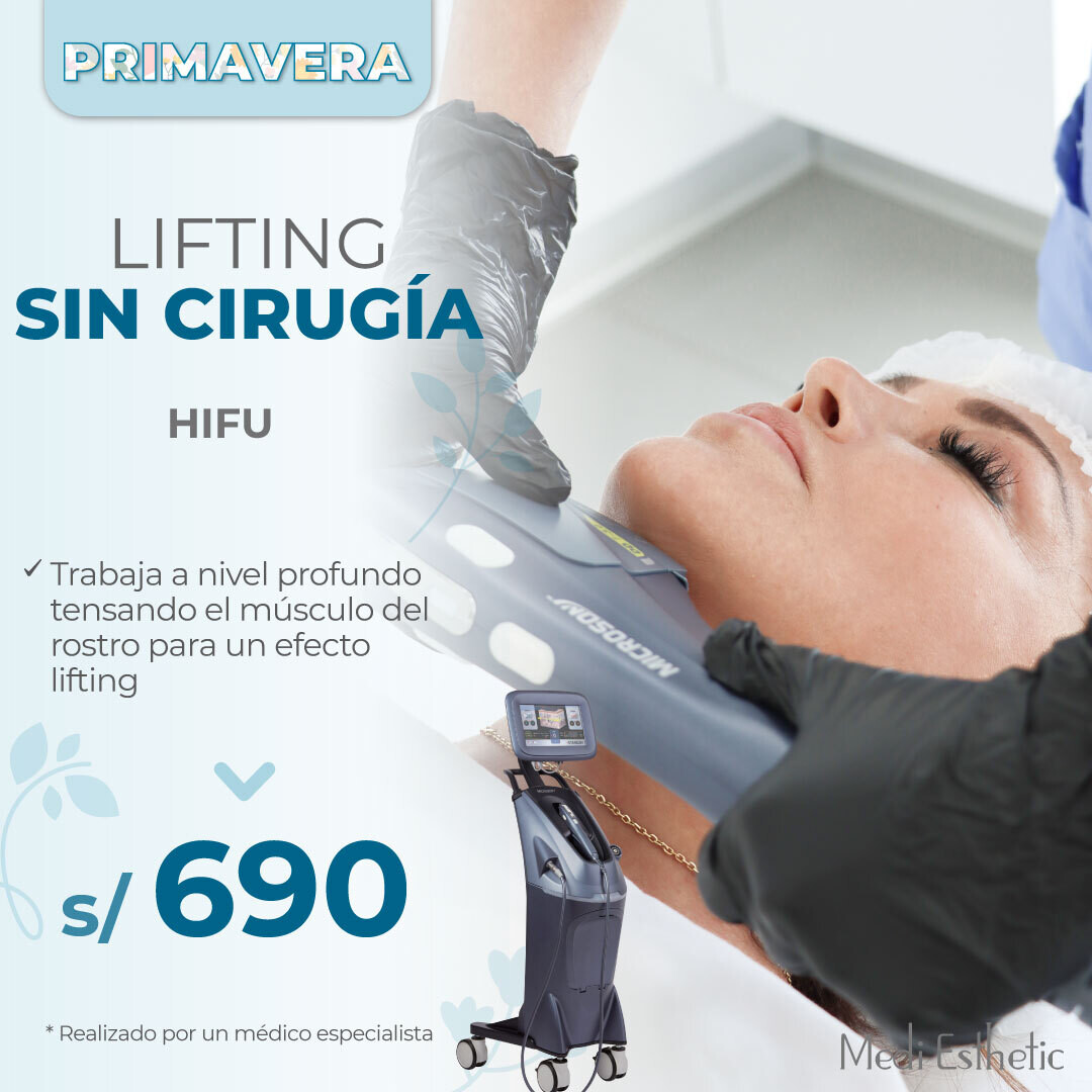 Lifting sin cirugías