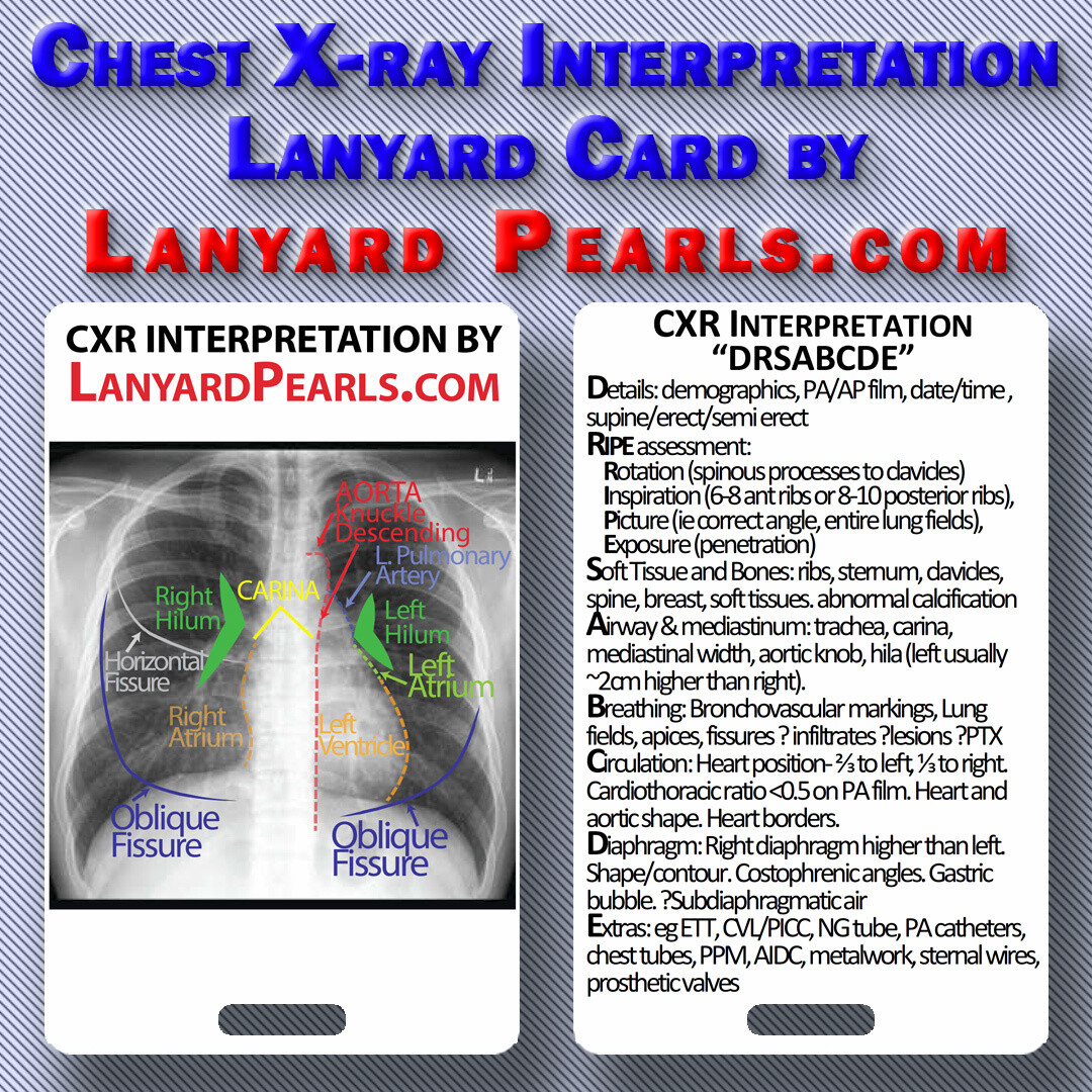 Chest X-Ray (CXR) Interpretation Lanyard Card |AUD$2.99