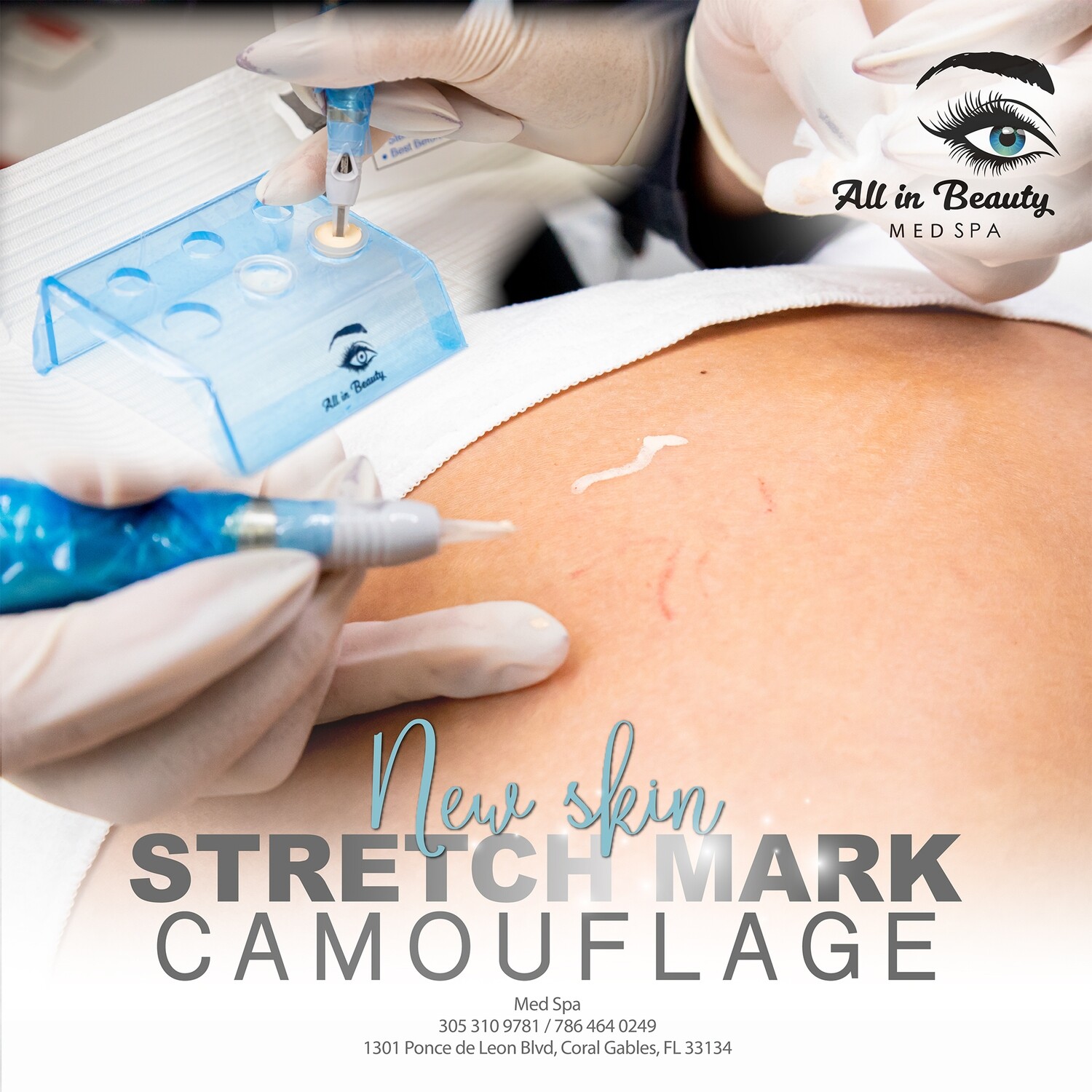 Stretch Mark Camouflage