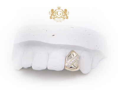 VVS Diamond Teeth & Grillz