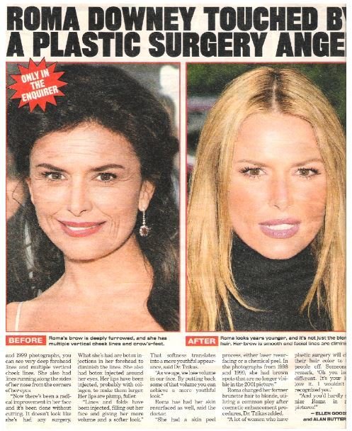 Downey, Roma / Touched By a Plastic Surgery Angel | Magazine Article ...