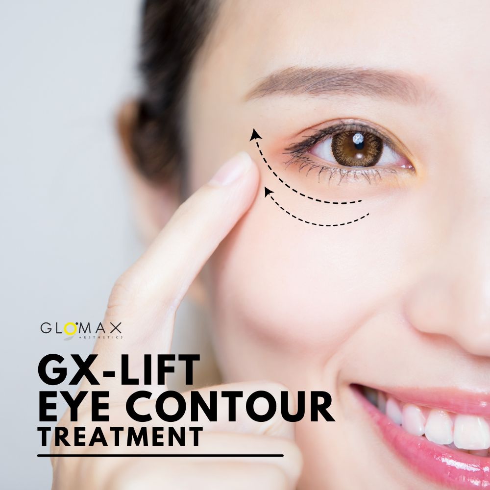 GX-Lift Face Contour Treatment for $99. INDIBA RF (activ ProRecovery ...
