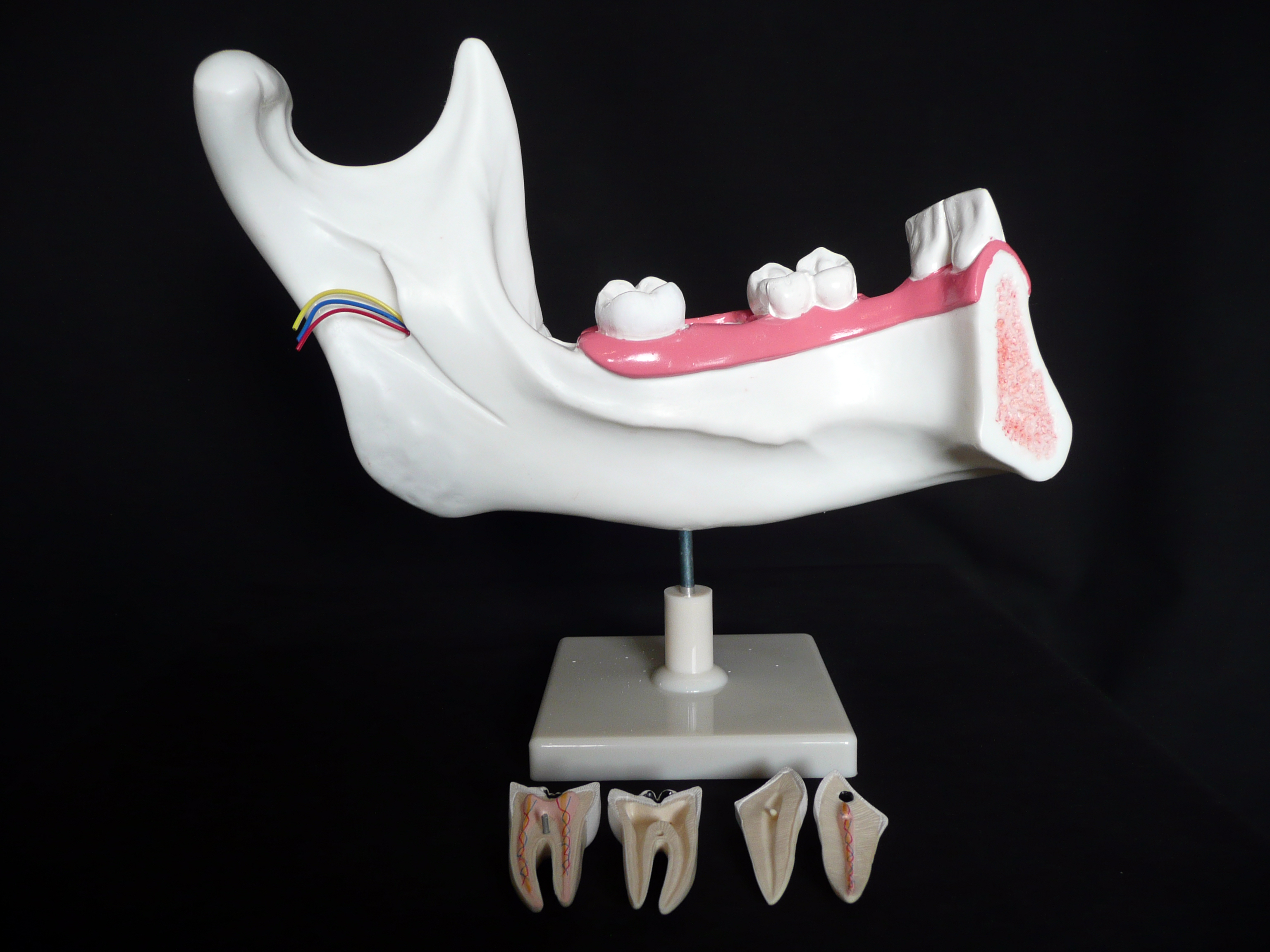 Anatomical Human Lower Jaw Mandible Teeth Model | Teeth Models ...