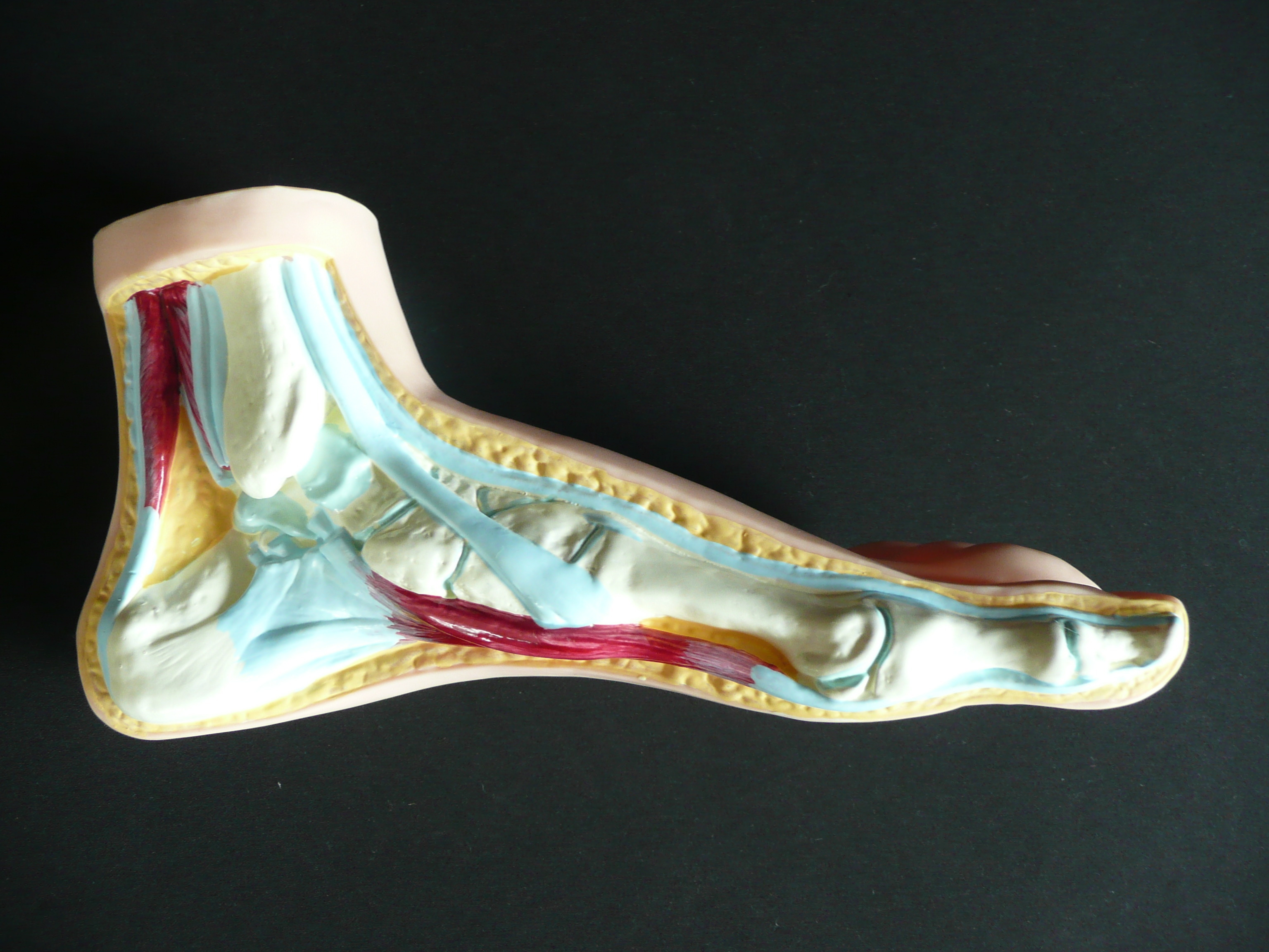 Anatomical Human Normal, Flat and Arched Feet Model | Joints – Store ...