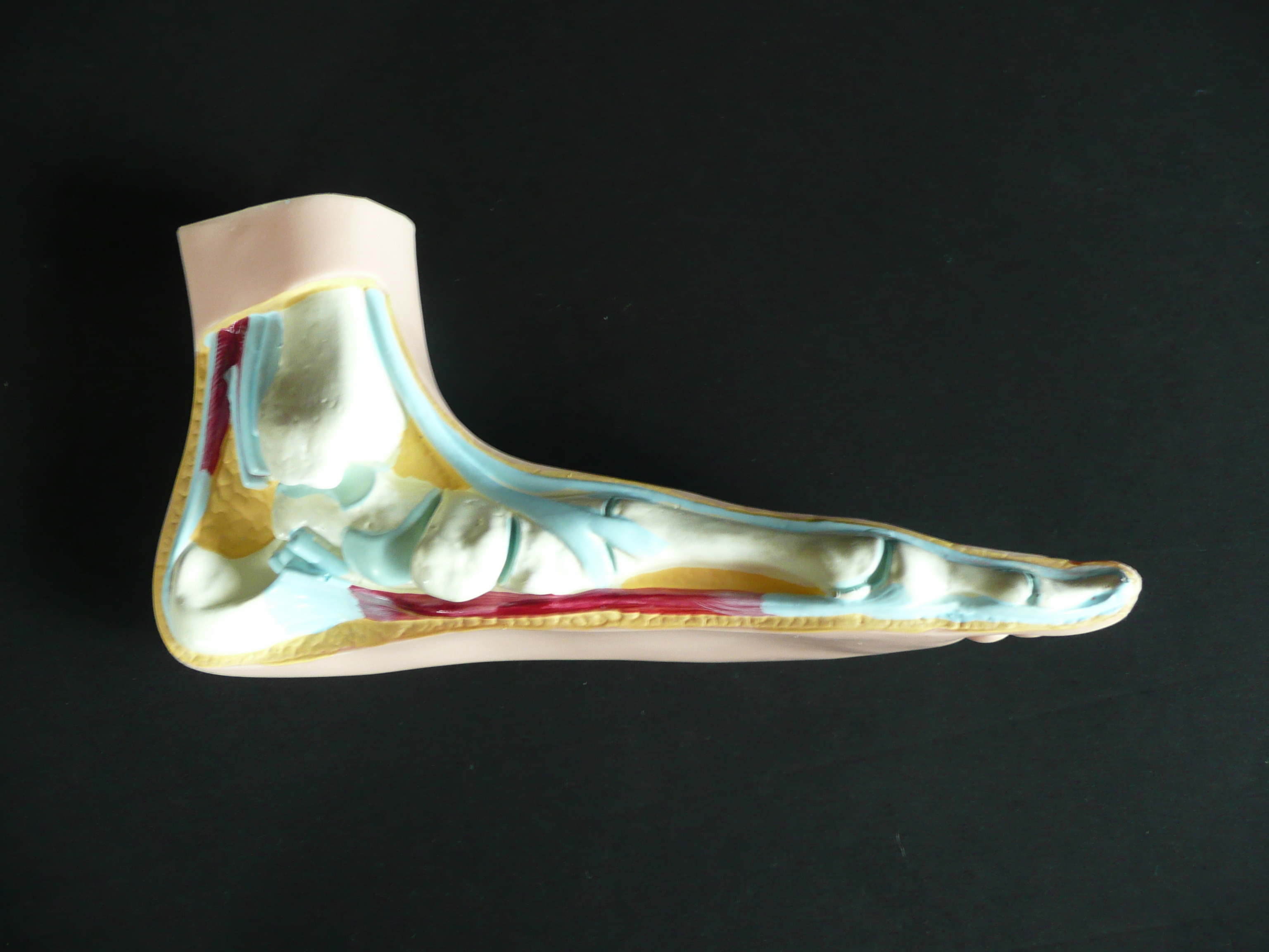Anatomical Human Normal, Flat and Arched Feet Model | Joints – Products ...