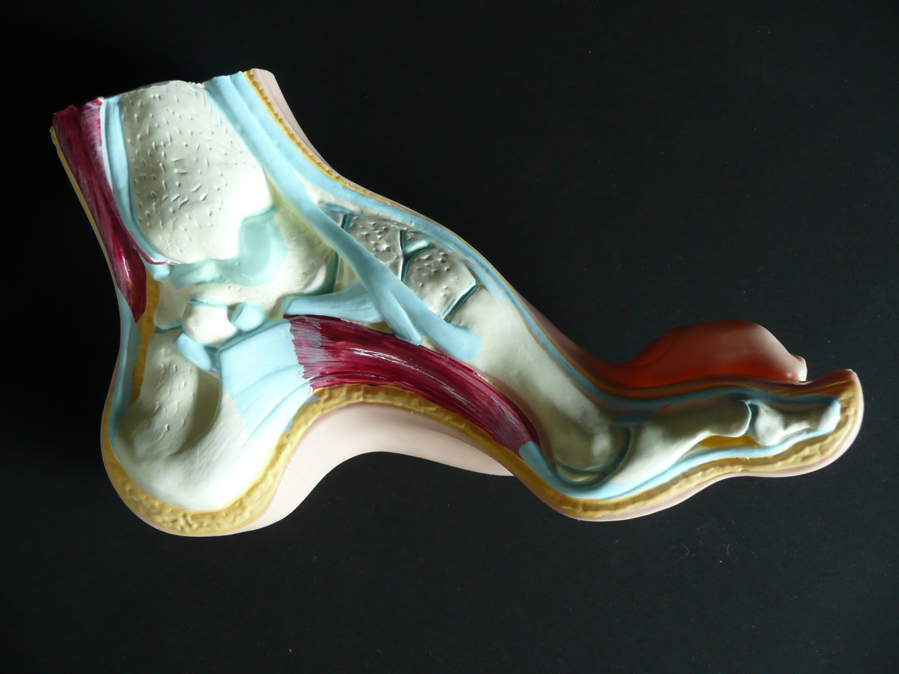 Anatomical Human Normal, Flat and Arched Feet Model | Joints – Products ...