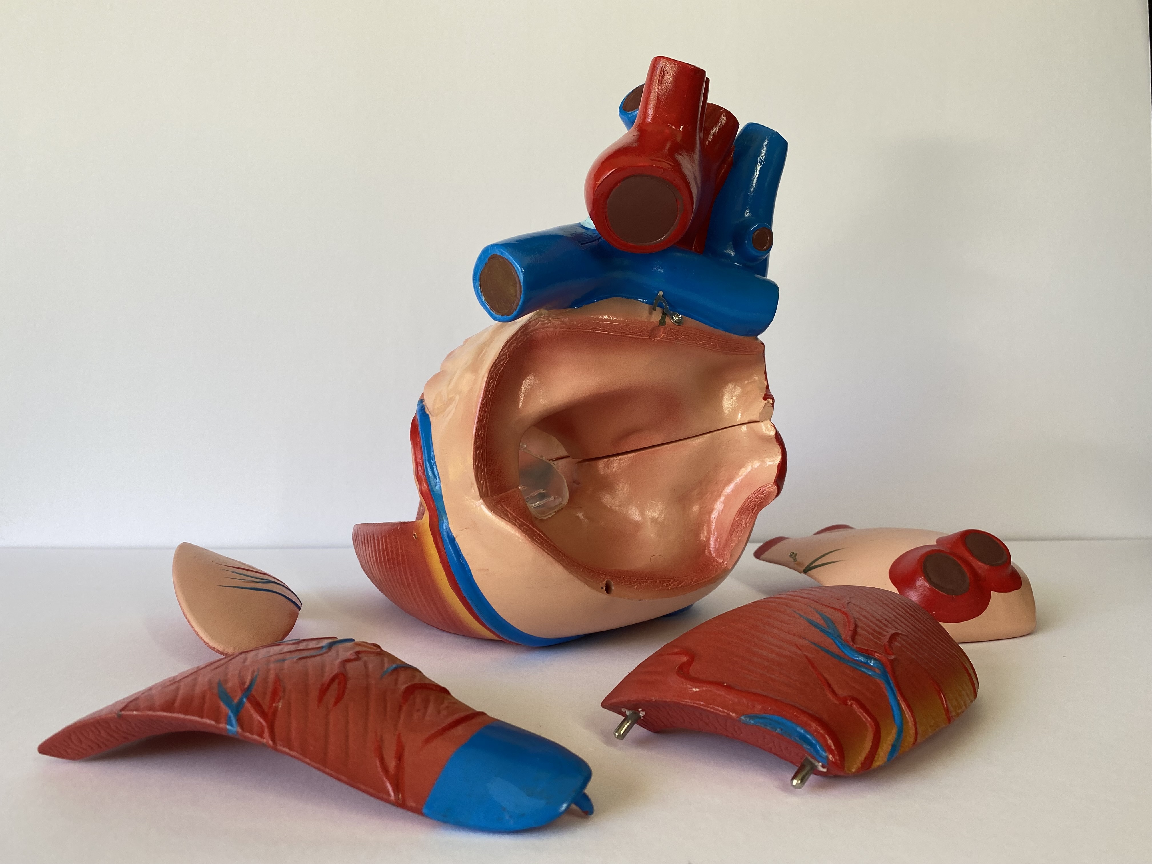 Advanced Enlarged Anatomical Human Heart Model | Heart and Lung Models ...