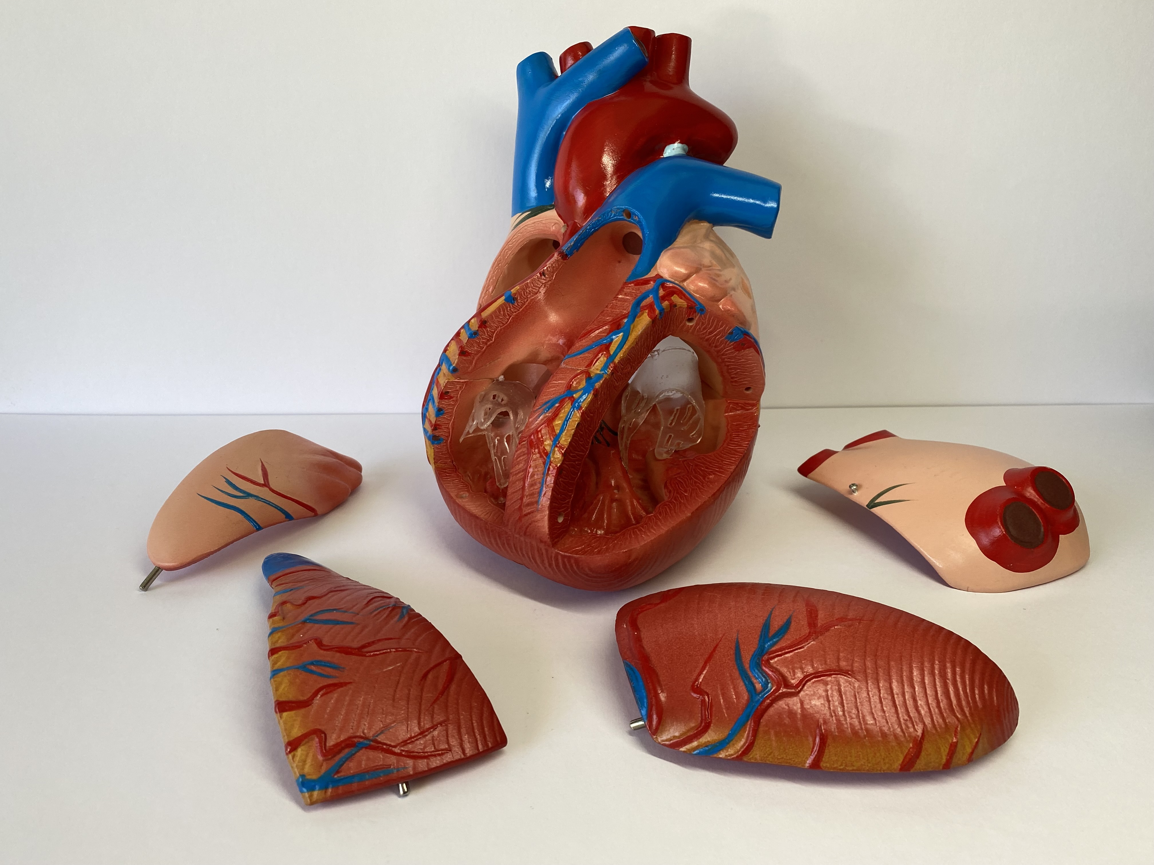 Advanced Enlarged Anatomical Human Heart Model | Heart and Lung Models ...