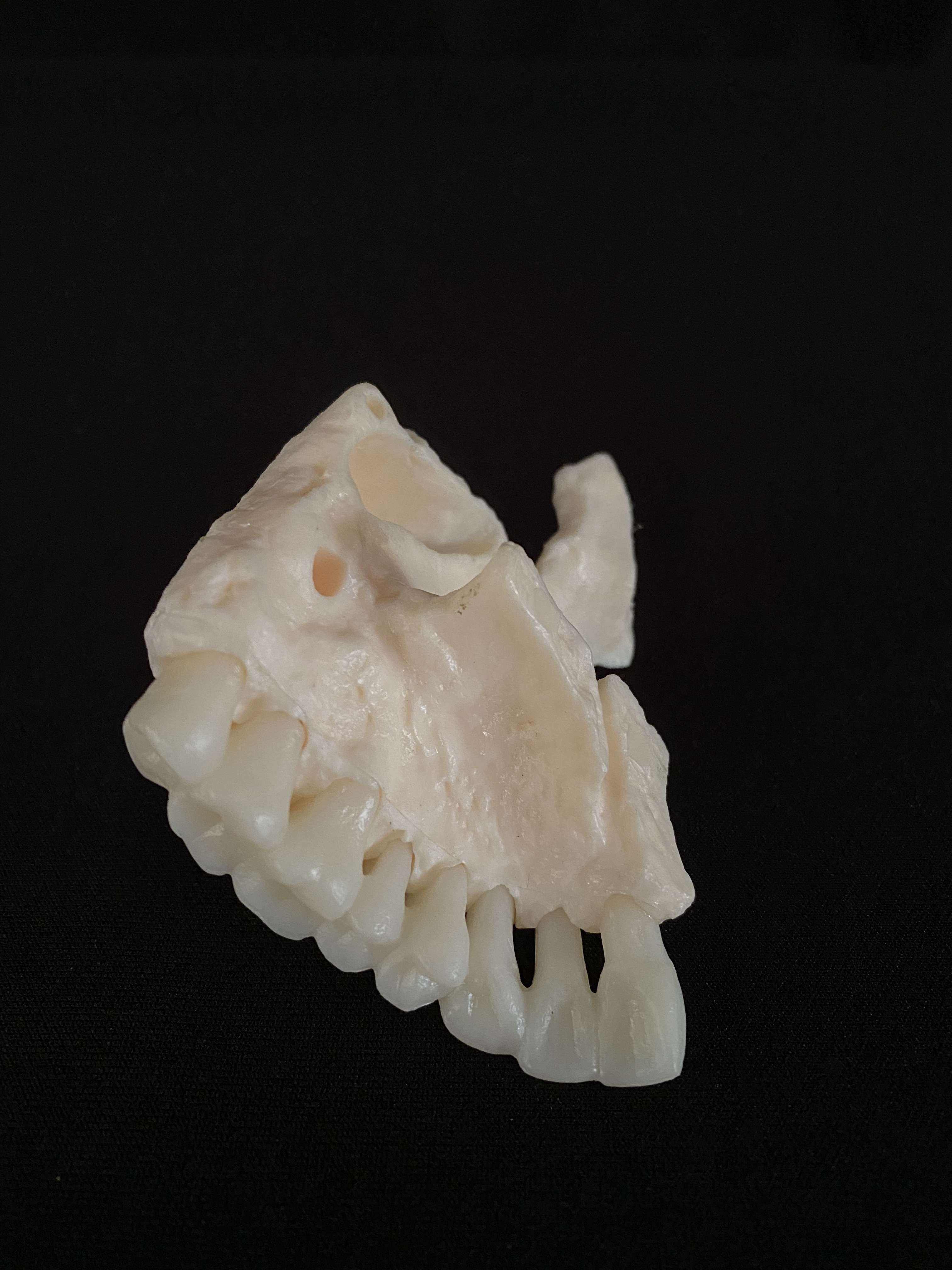 Maxilla Bone with Teeth Model | Skull Models – Store – Medical Models