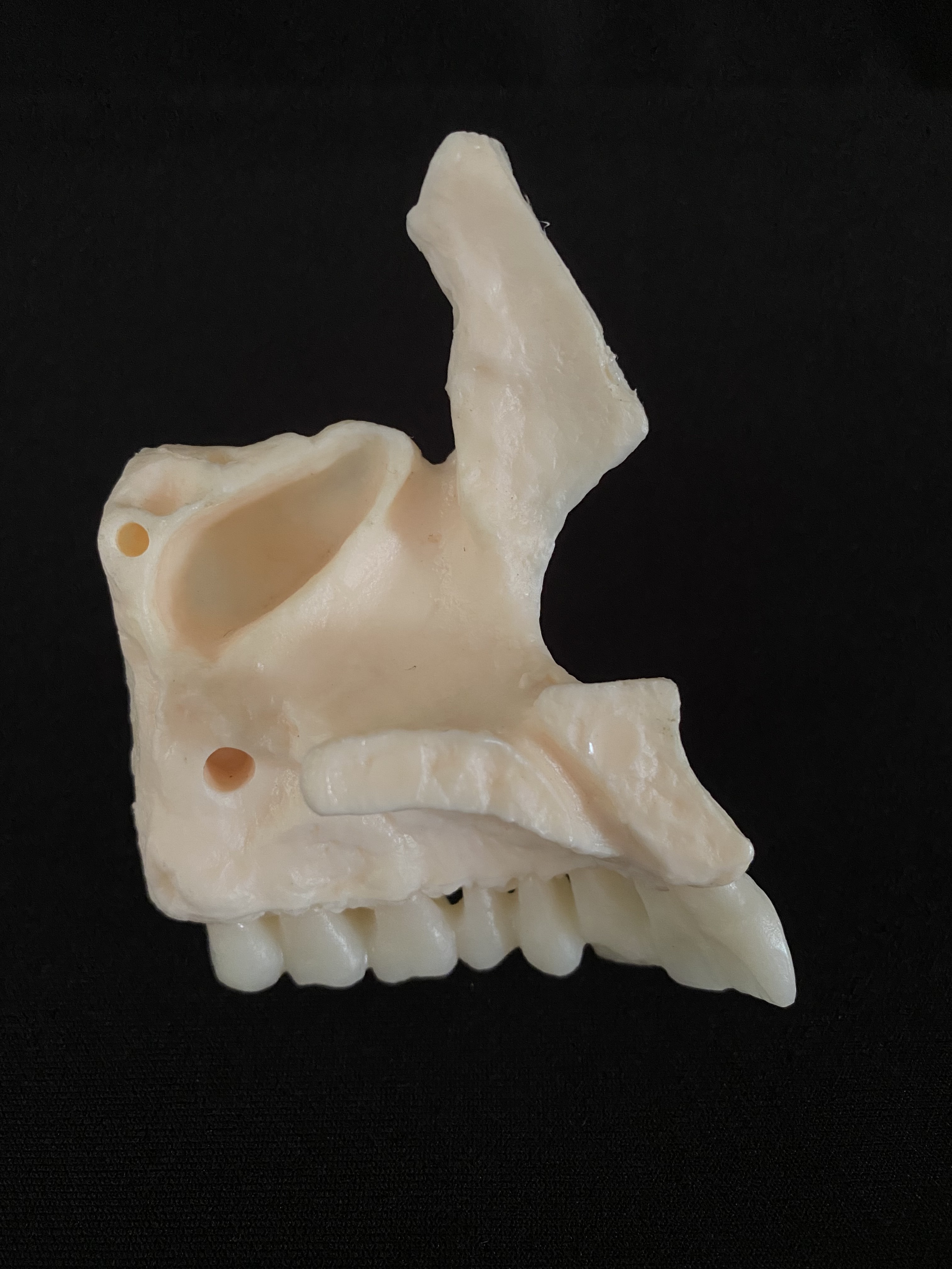 Maxilla Bone with Teeth Model | Skull Models – Store – Medical Models