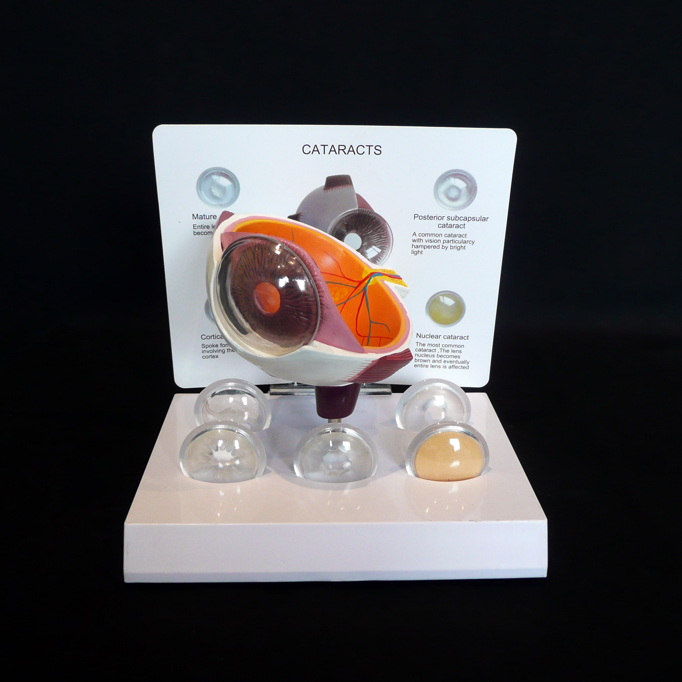 Anatomical Human Cataract Eye Model | Eye Models – Products – Medical ...