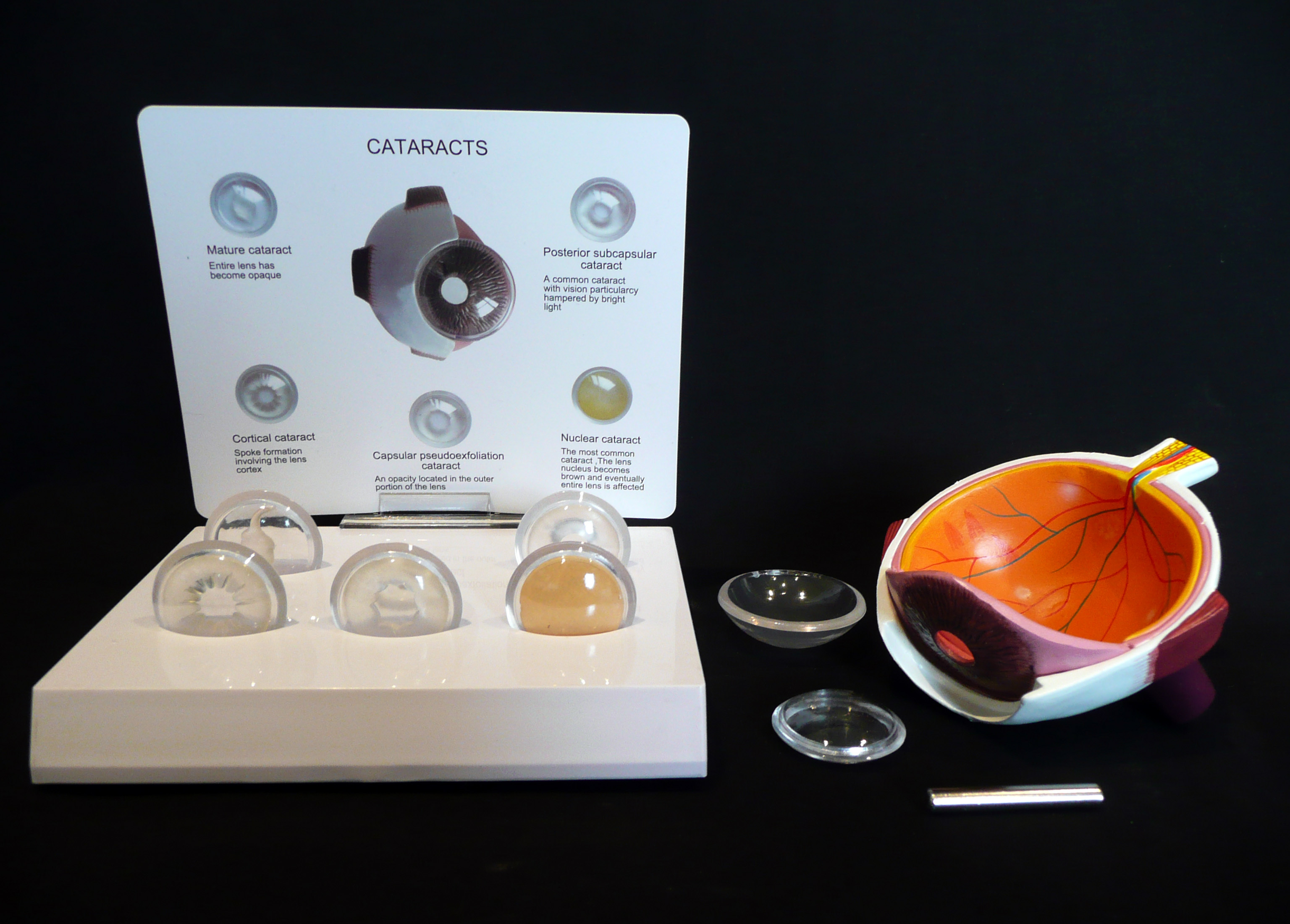 Anatomical Human Cataract Eye Model | Eye Models – Products – Medical ...