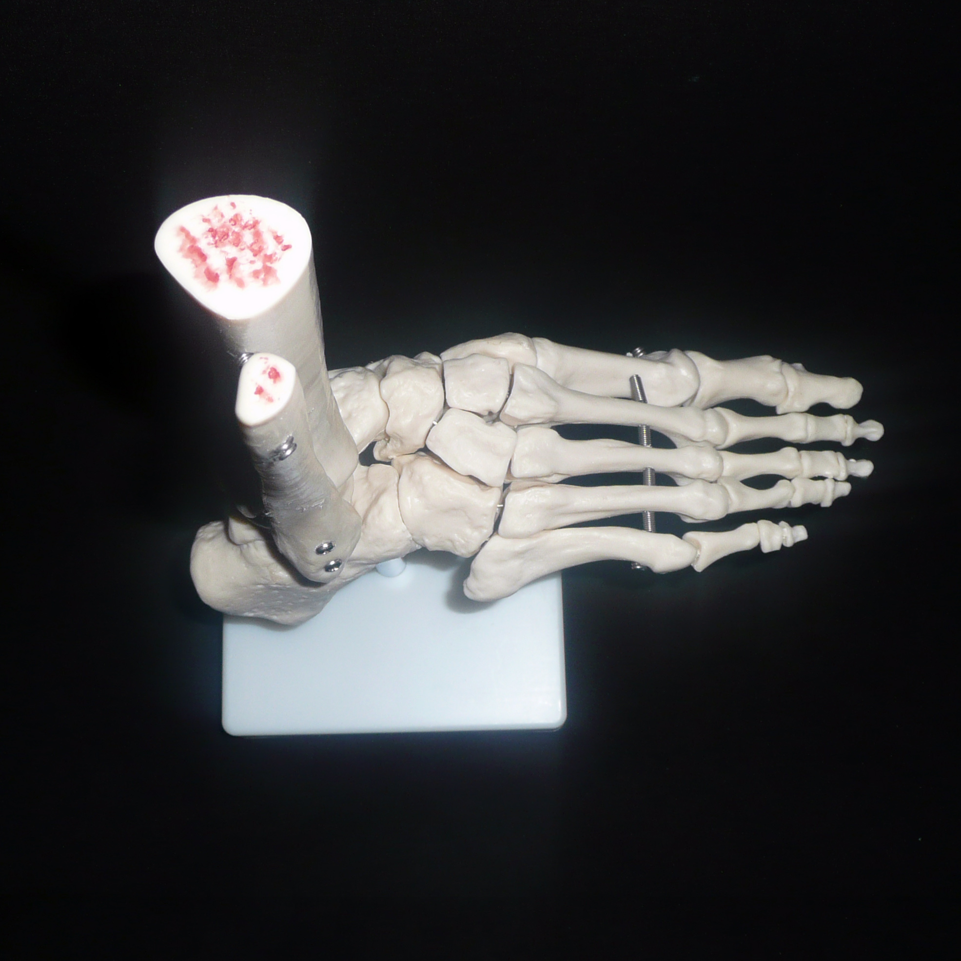 Life-Size Anatomical Human Foot/Ankle Joint Model | Joints – Products ...