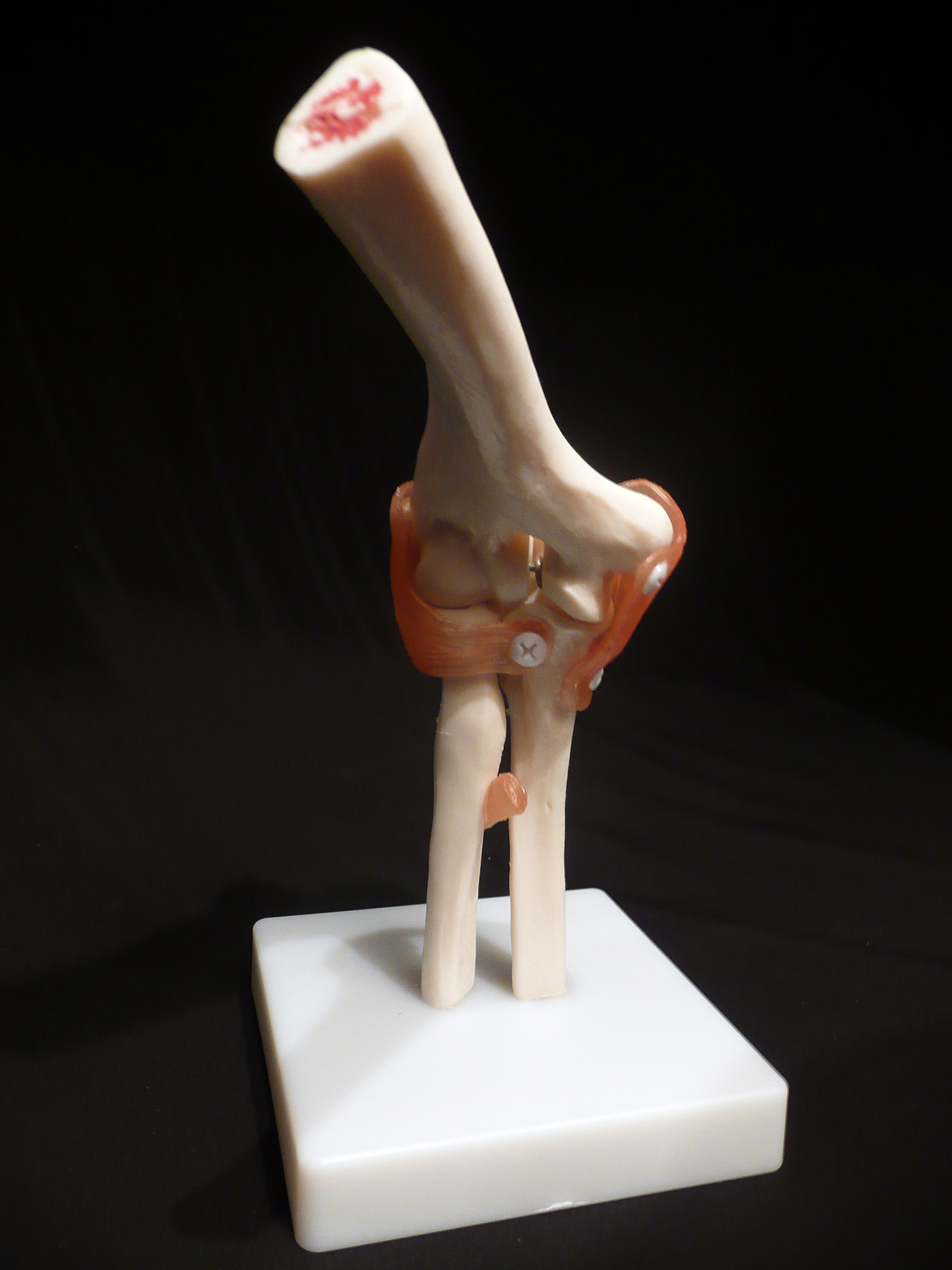Life-Size Anatomical Human Elbow Joint Model | Joints – Store – Medical ...