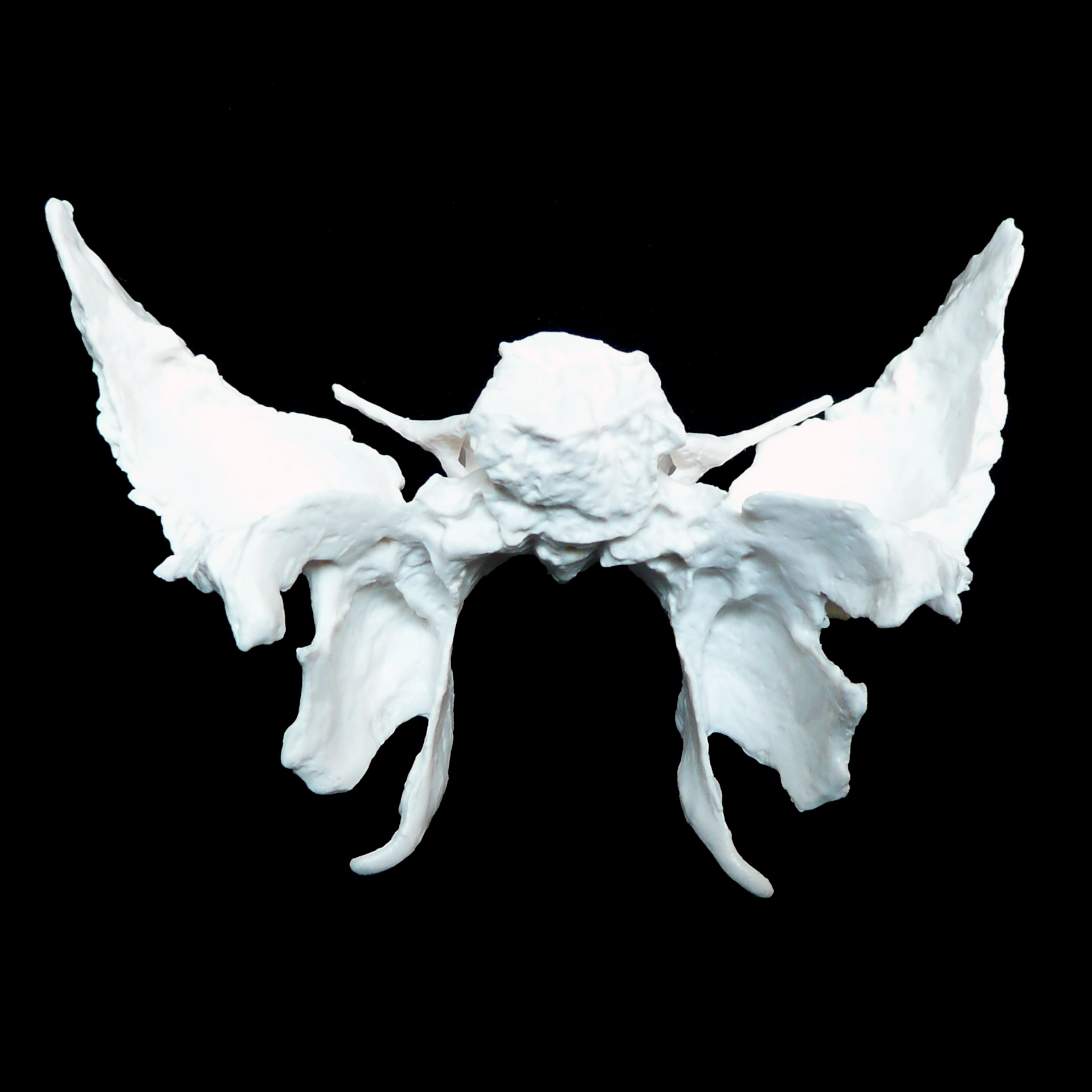 Anatomical Human Sphenoid Bone Model | Skull Models – Products ...