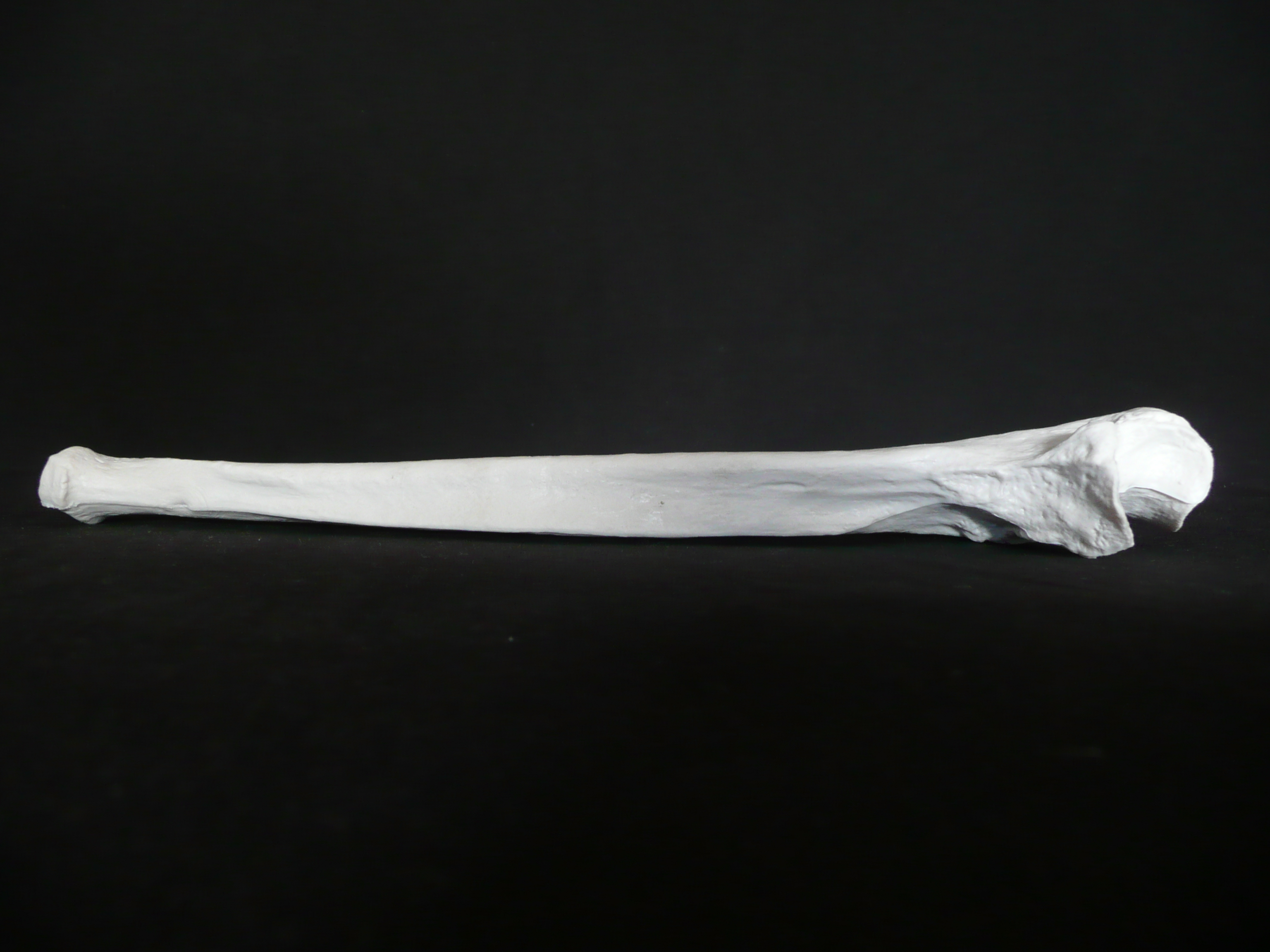 Anatomical Radius and Ulna Bone Models of the Human Arm | Skeletal ...
