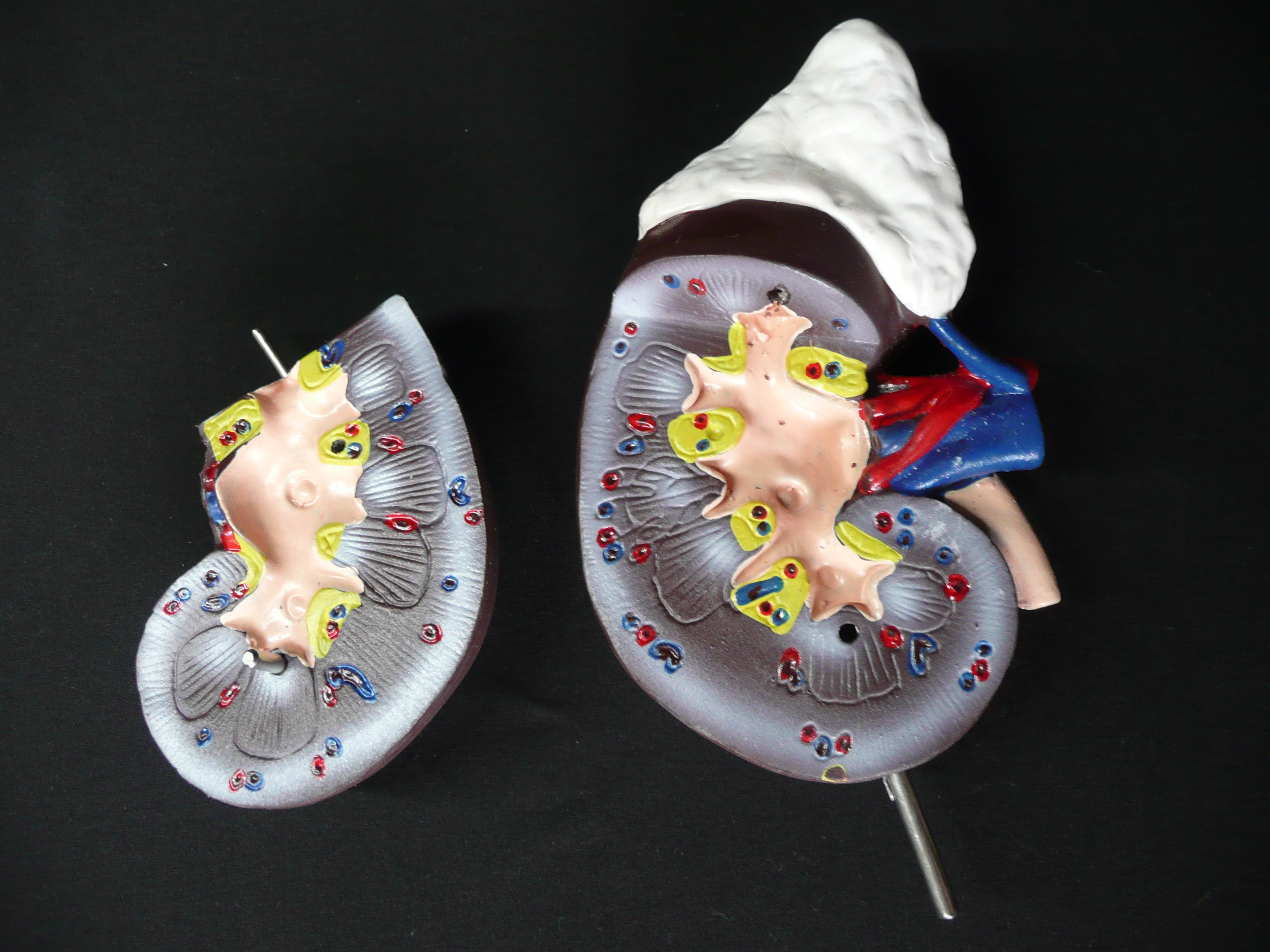 Anatomical Human Kidney with Adrenal Gland Model | Organs – Store ...