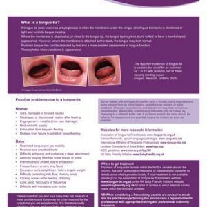 Tongue Tie Infant Feeding A5 Leaflet