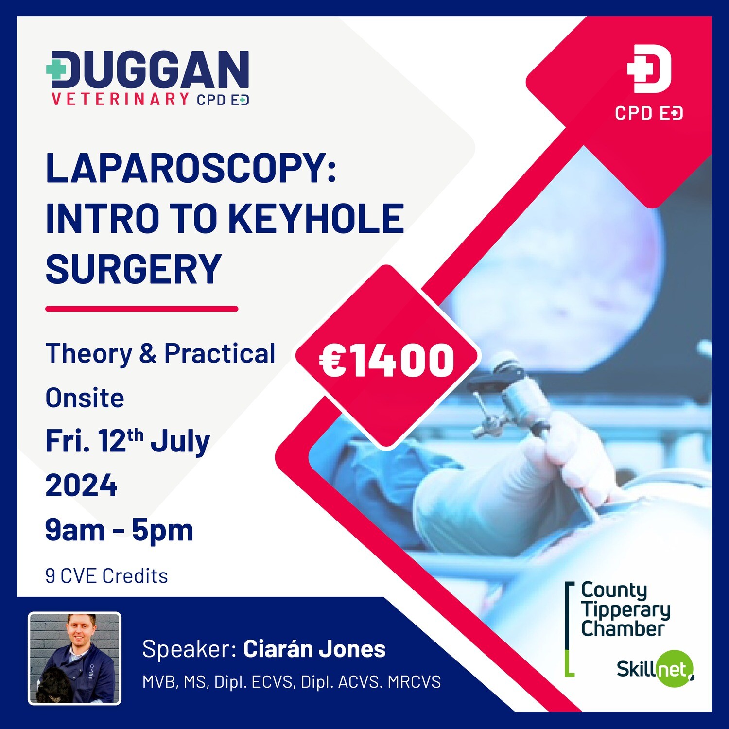 Laparoscopy: An introduction to keyhole surgery