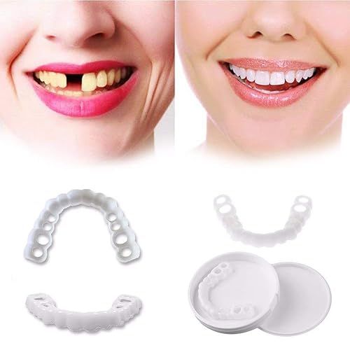 Snap-On Temporary Teeth: What They Are & How They’re Used